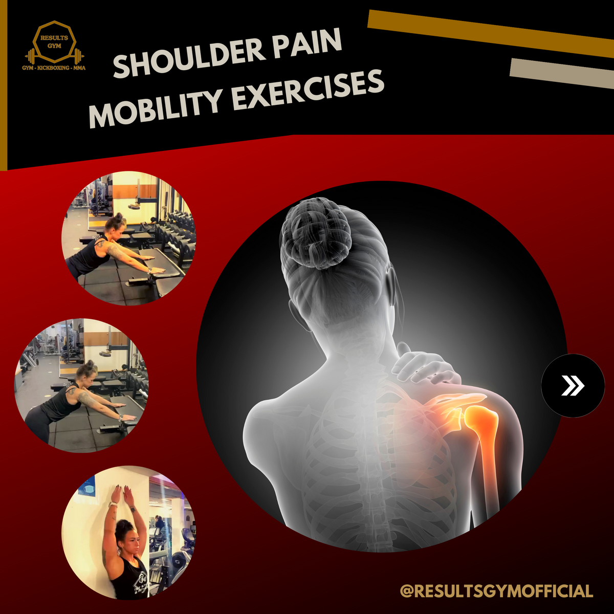 Mobility & Joint Issues #2 Do you have shoulder joint pain? – Results Gym